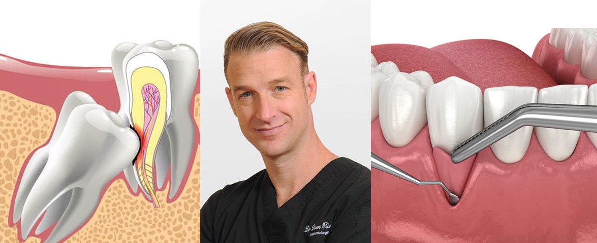 Dr. Dave Rioux : Guest dentist at the clinic - Clinique dentaire ...